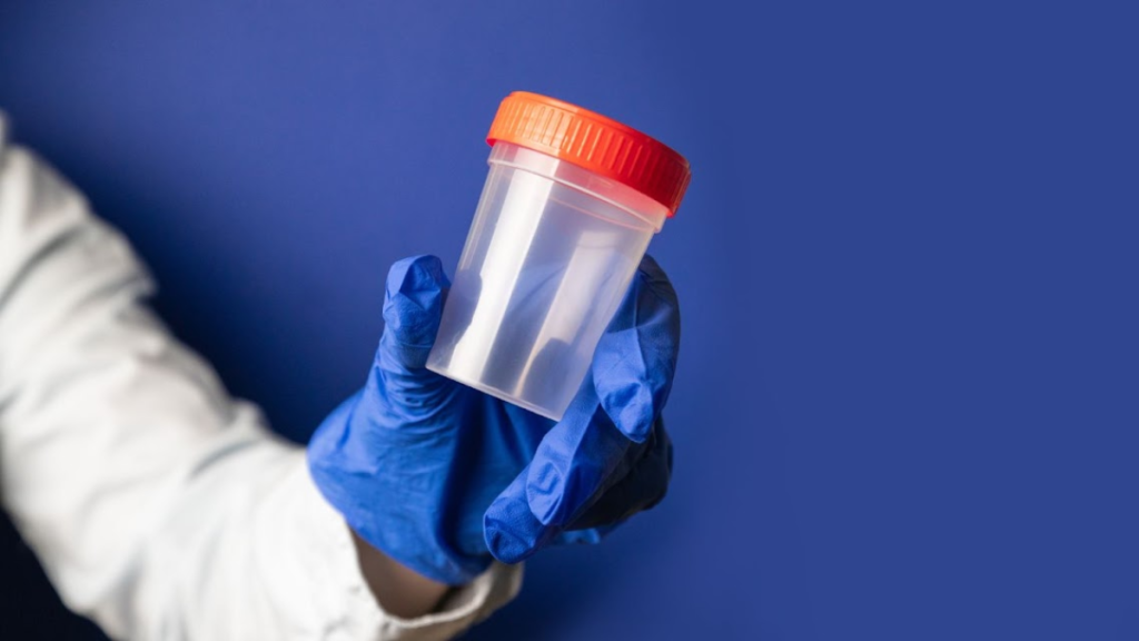 Exploring Most Common Drug Test For Employment - The Hustler's Digest
